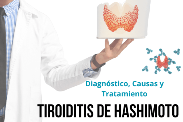 ᐉ Tiroiditis de HASHIMOTO, Causas, Diagnóstico y Tratamiento
